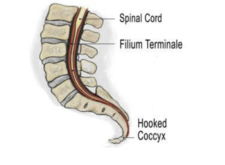 Coccyx The Seat of the Soul